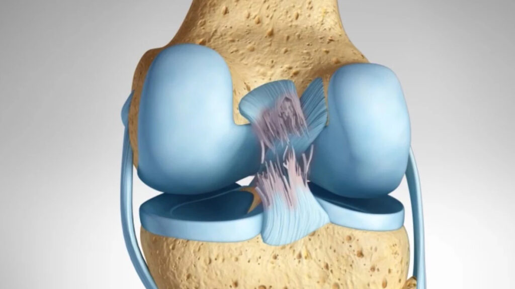 Best Orthopedic Surgeon in Nashik & Advanced Orthopedic Care